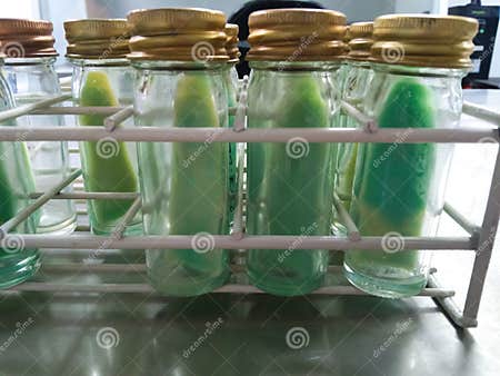 Solid Lowensteinâ€“Jensen Agar Medium Bottle. Stock Image - Image of ...
