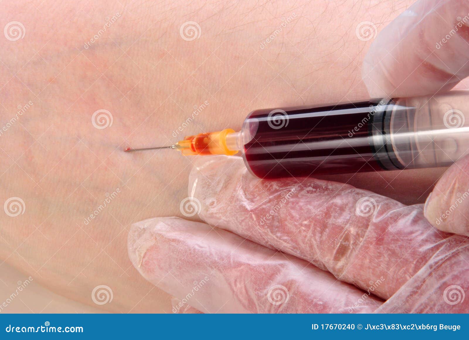 Some Human Blood for a Test Stock Photo - Image of syringe, doctor ...
