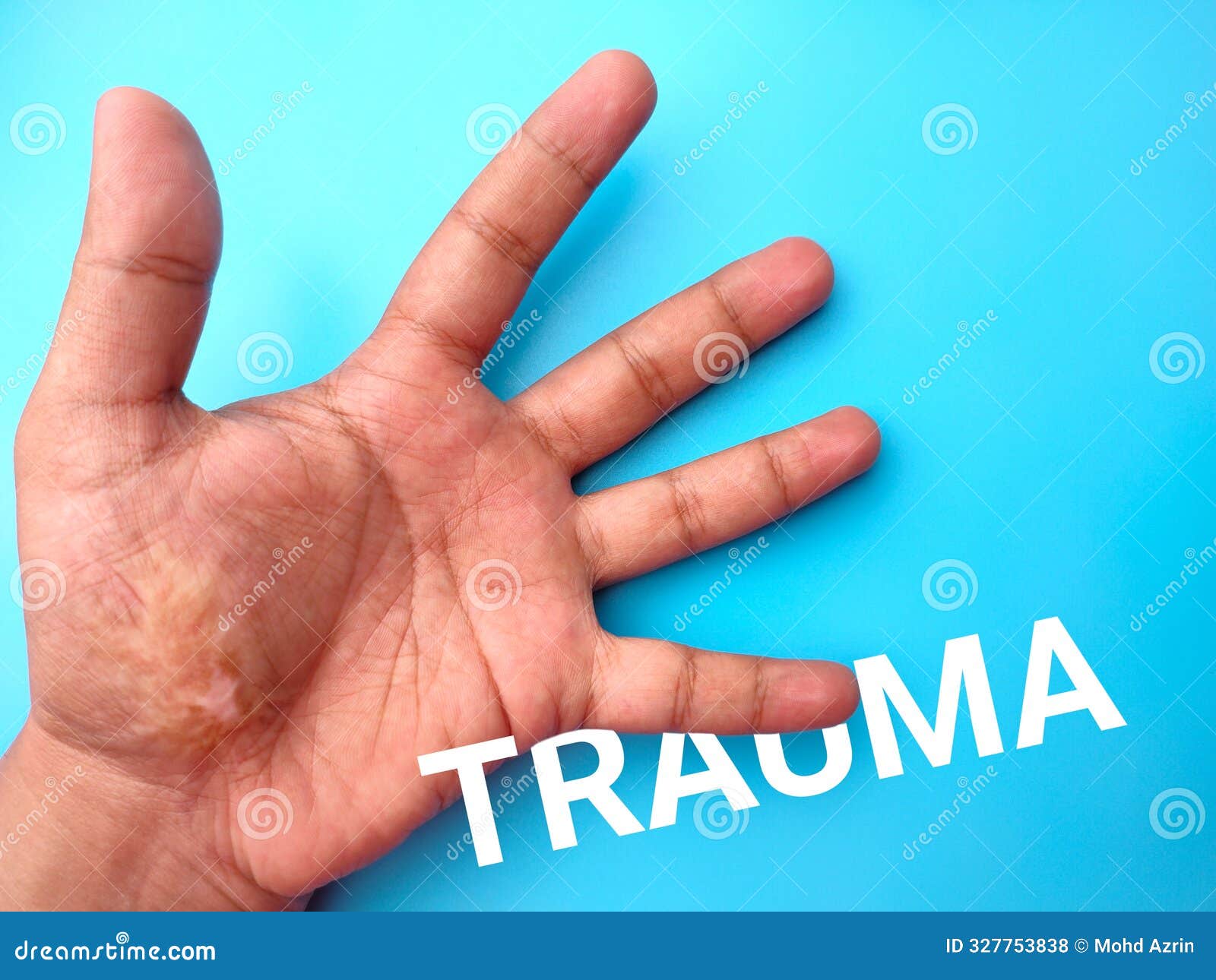 The Word Trauma Written On Wooden Cubes Stock Photo | CartoonDealer.com ...