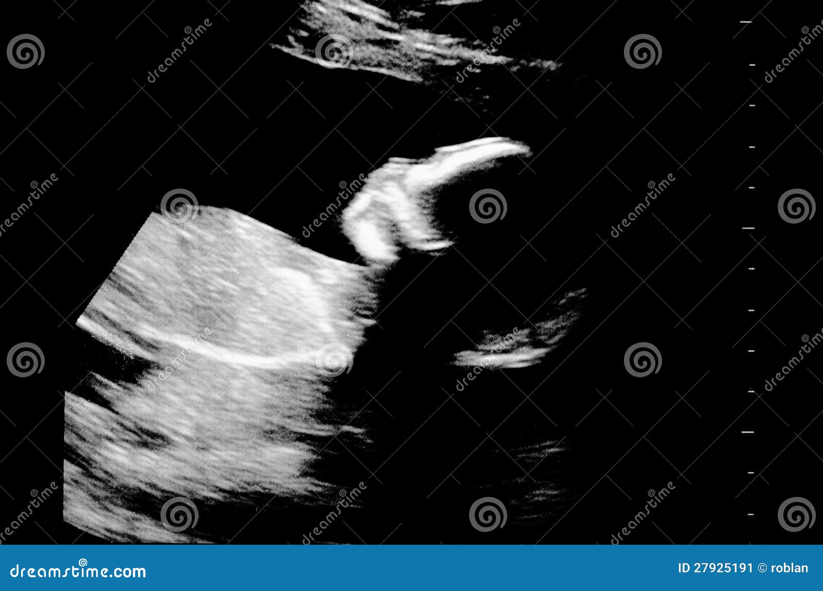 Sonogram stock image. Image of face, white, umbilical - 27925191