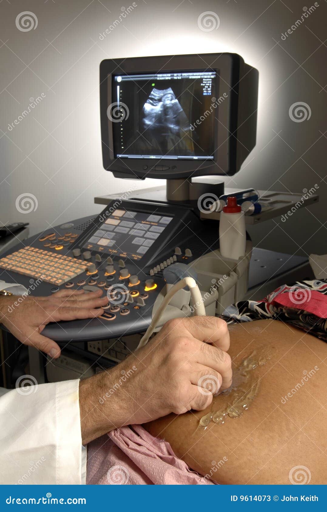 Sonogram stock image. Image of antenatal, monitoring, imaging - 9614073