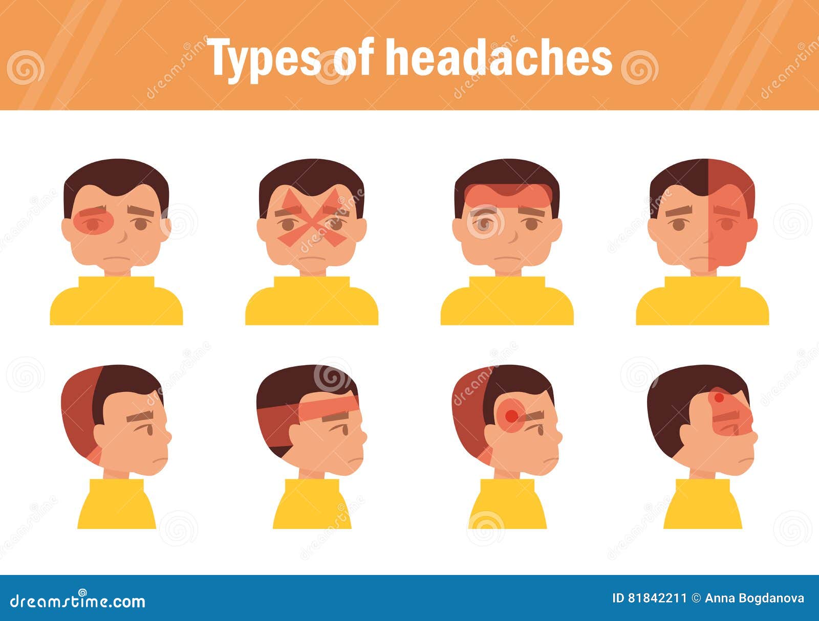 Soorten hoofdpijnen Vector vector illustratie. Illustration of pijn ...