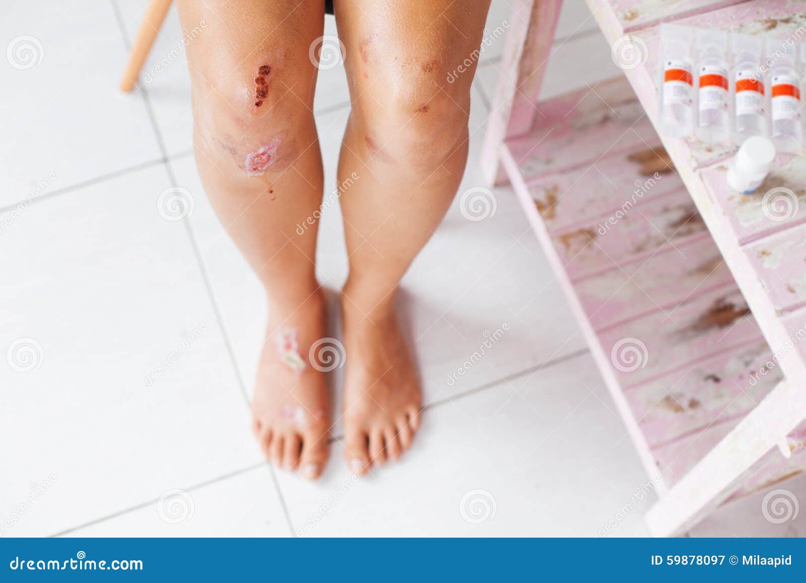 Sore legs stock image. Image of health, help, emergency - 59878097