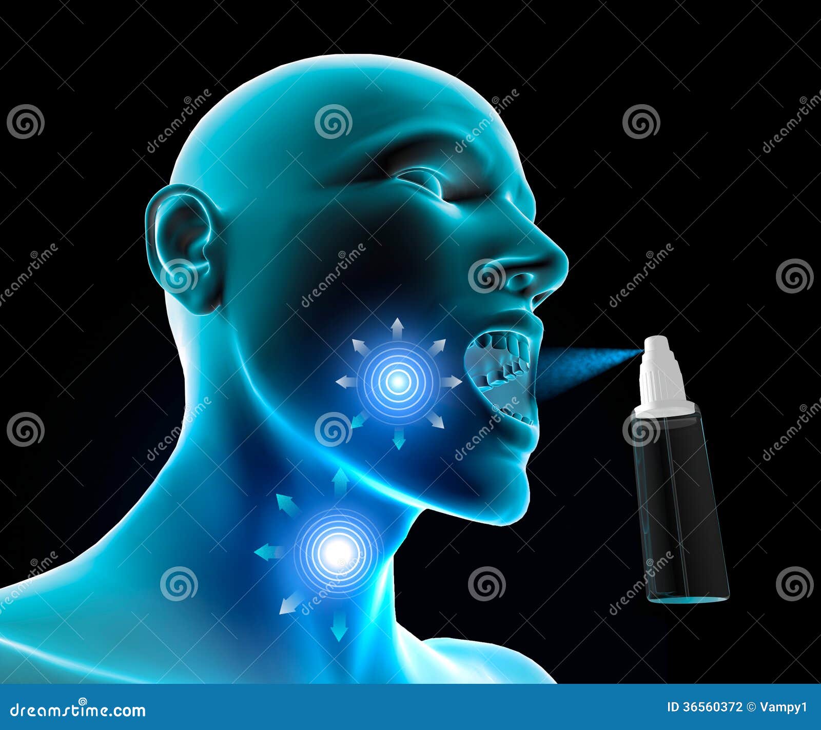 Sore throat inflammation stock illustration. Illustration of gorge ...