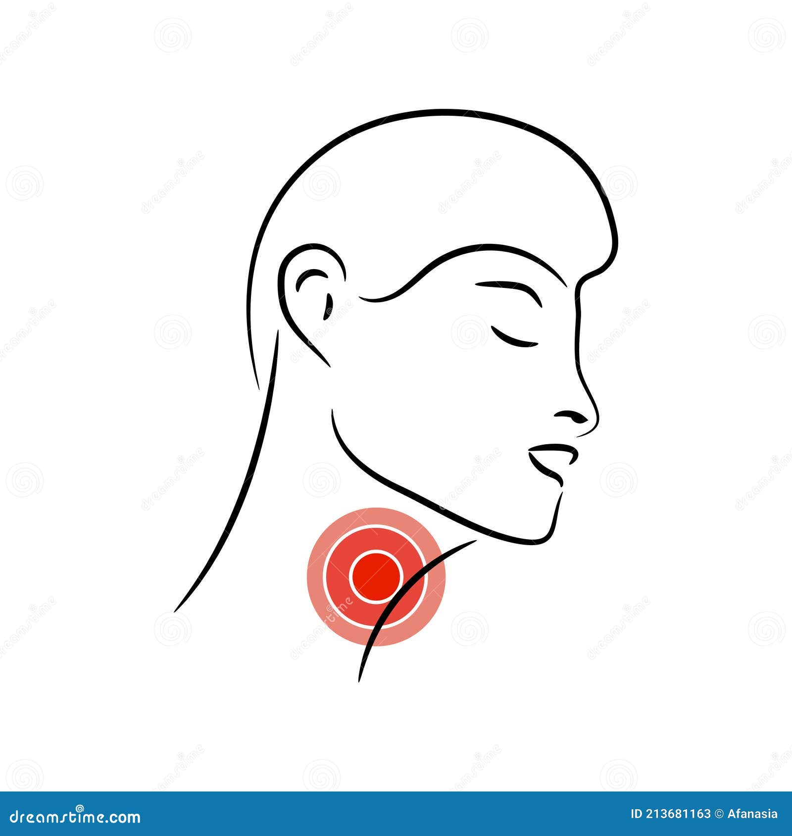 Sore Throat Vector Illustration. Feeling Pain in Throat Stock Vector ...