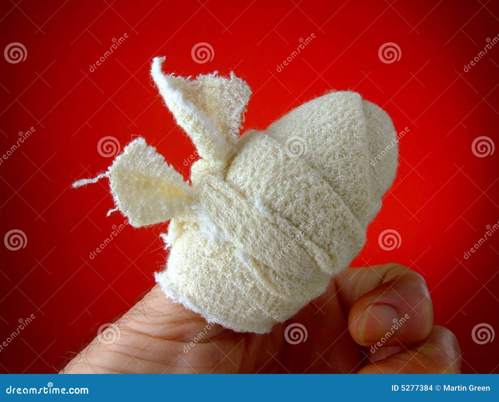 Sprained Thumb In Medical Splint Royalty-Free Stock Photo ...