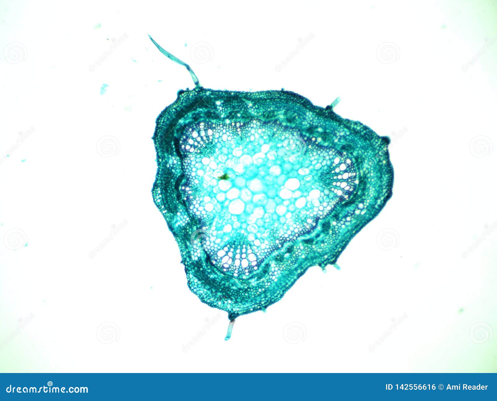 Soya Stem 100x Magnification Cross Section Stock Photography ... Soya Stem 100x Magnification Cross Section Stock Photography ...