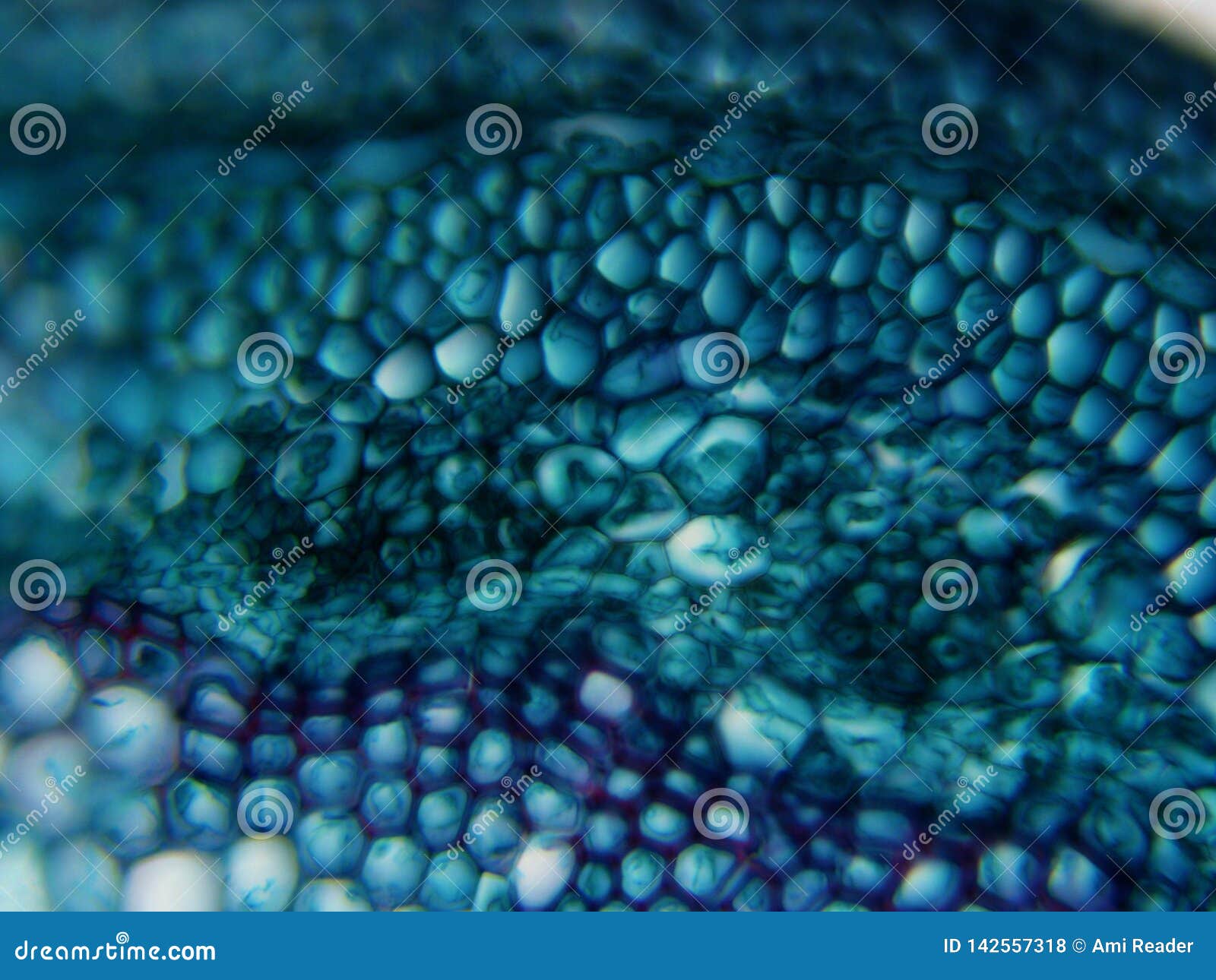 Soya Stem 100x Magnification Cross Section Stock Photography ... Soya Stem 100x Magnification Cross Section Stock Photography ...