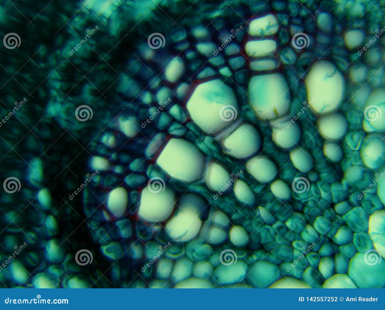 Soya Stem 100x Magnification Cross Section Stock Photography ... Soya Stem 100x Magnification Cross Section Stock Photography ...