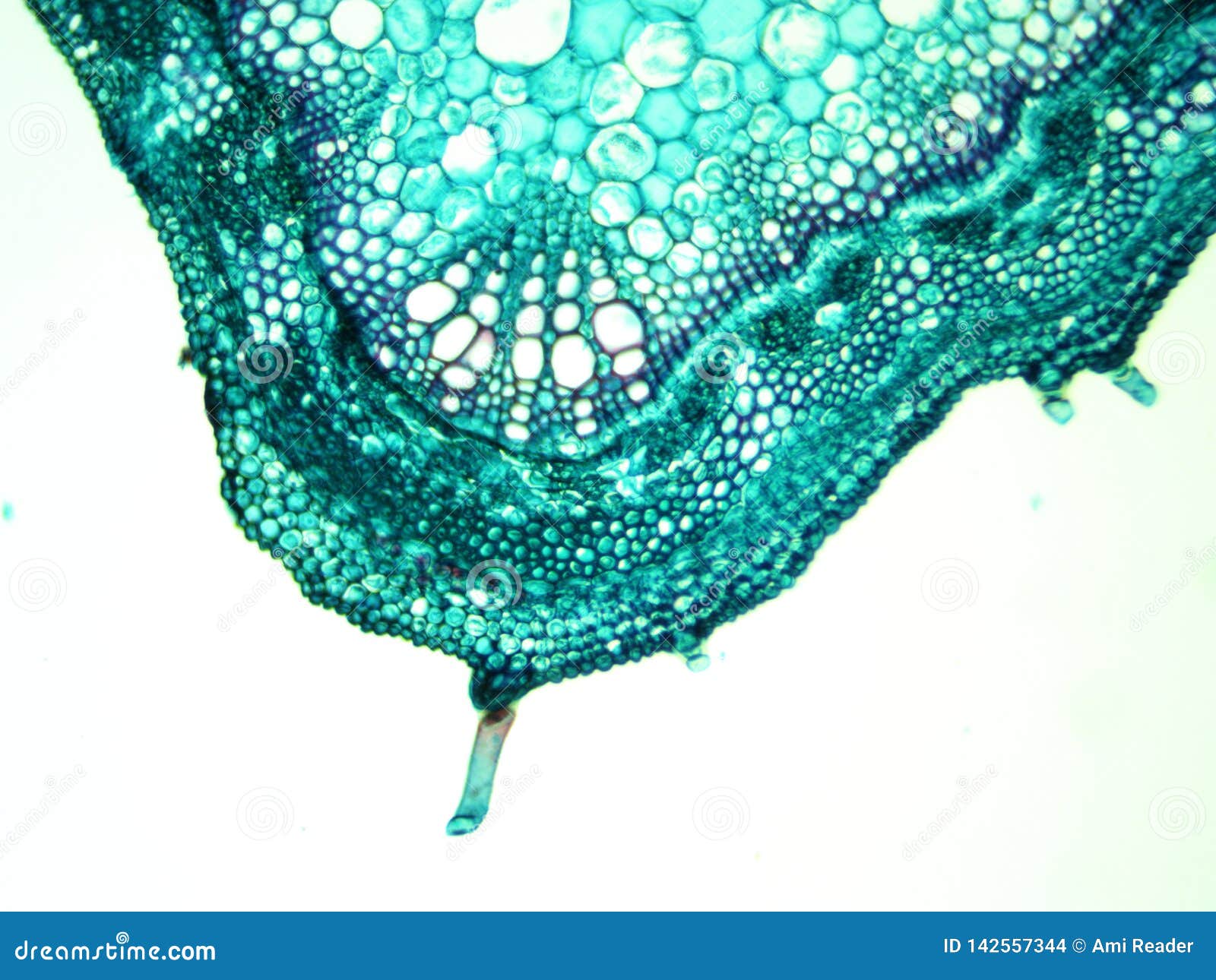 Soya Stem 100x Magnification Cross Section Stock Photo - Image of ... Soya Stem 100x Magnification Cross Section Stock Photo - Image of ...