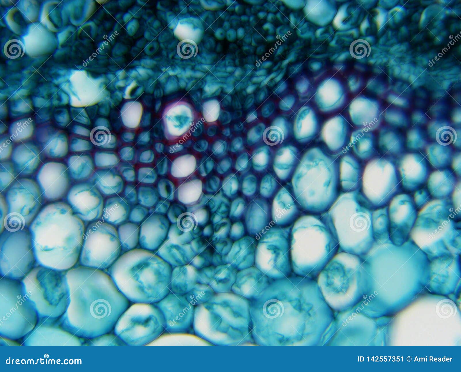 Soya Stem 400x Magnification Cross Section Stock Image - Image of ... Soya Stem 400x Magnification Cross Section Stock Image - Image of ...
