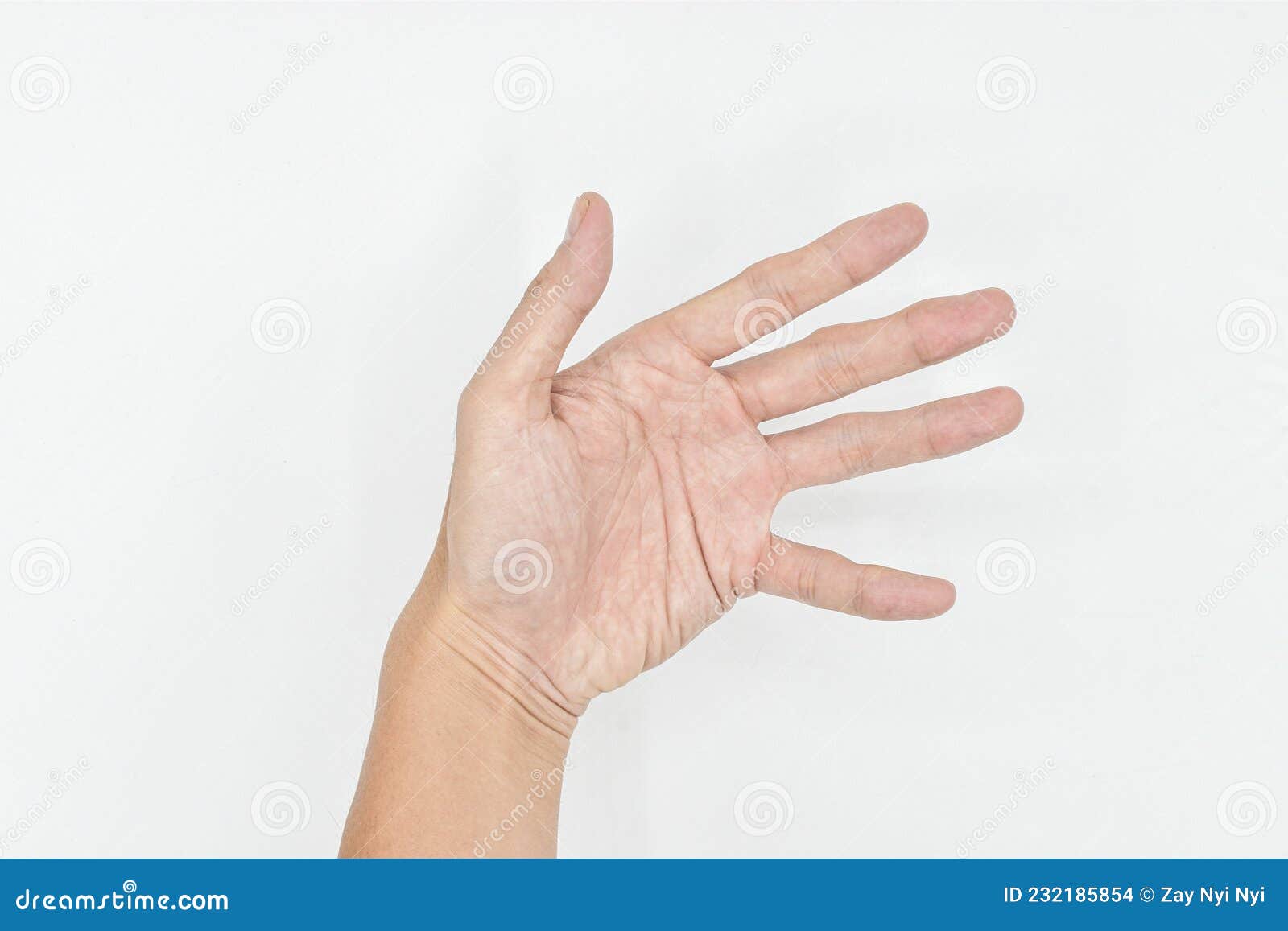 Spastic Hand. Hand Muscle Spasticity Stock Photo - Image of abnormality ...