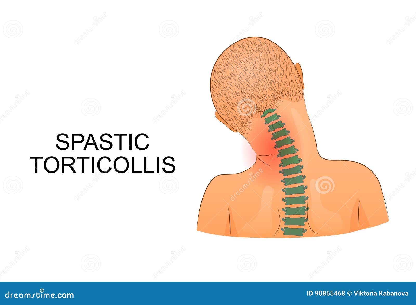 Torticollis Cartoons, Illustrations & Vector Stock Images - 10 Pictures ...