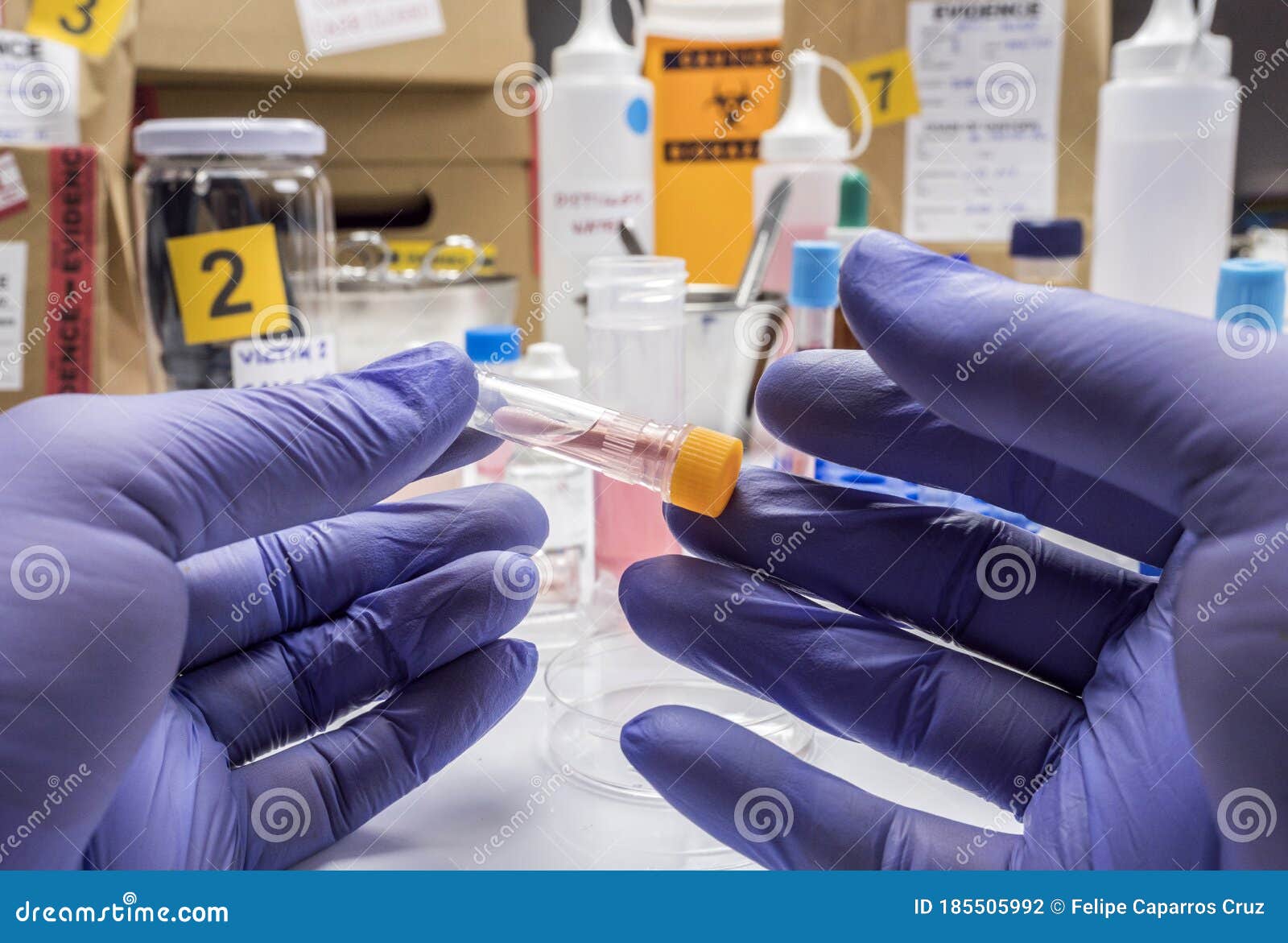 Specialized Criminalistic Police Performs Hematological Analysis with ...