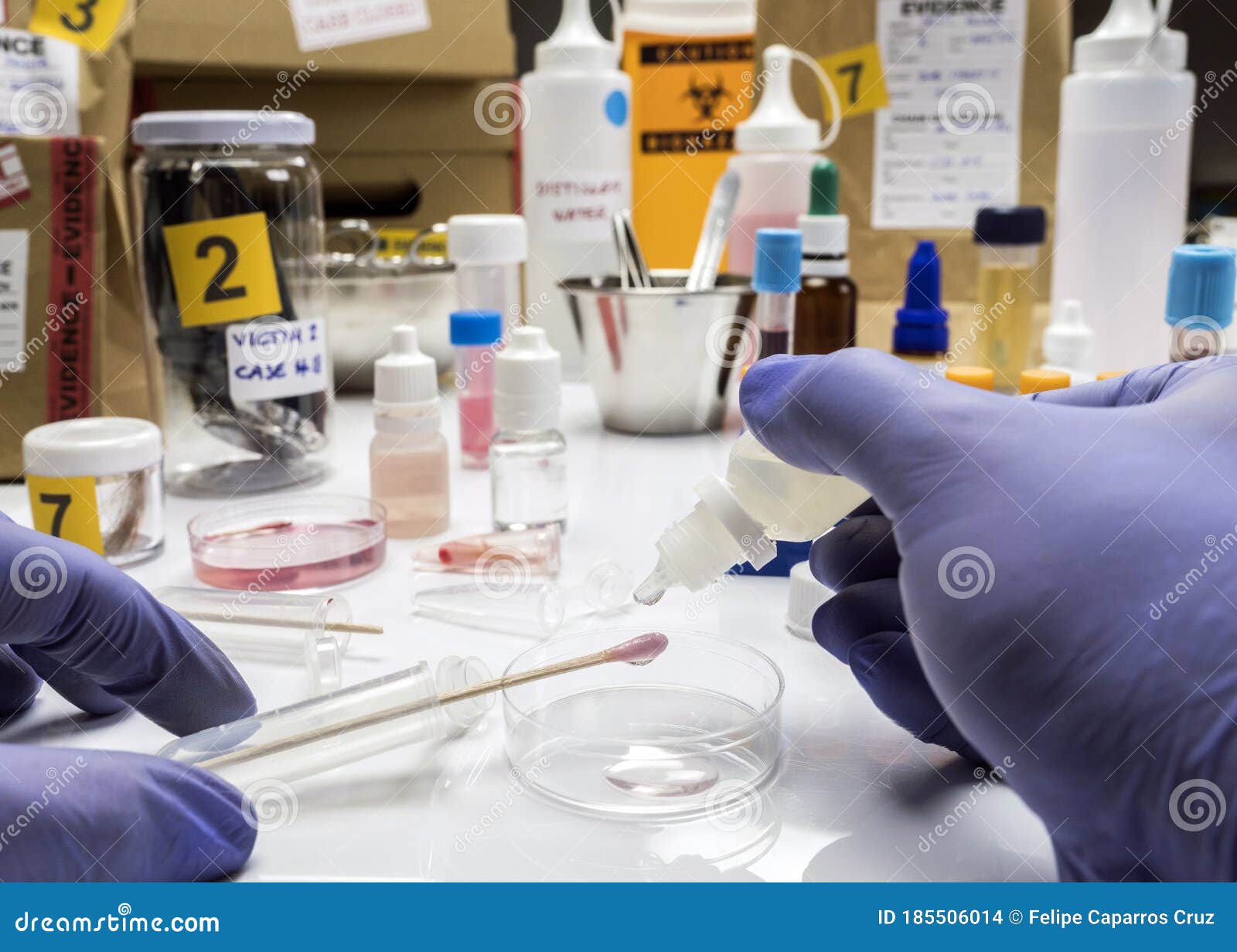 Specialized Criminalistic Police Performs Hematological Analysis With ...