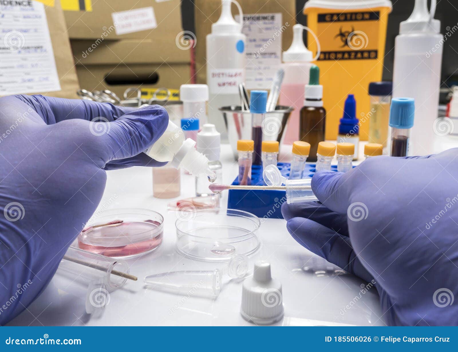 Specialized Criminalistic Police Performs Hematological Analysis with ...