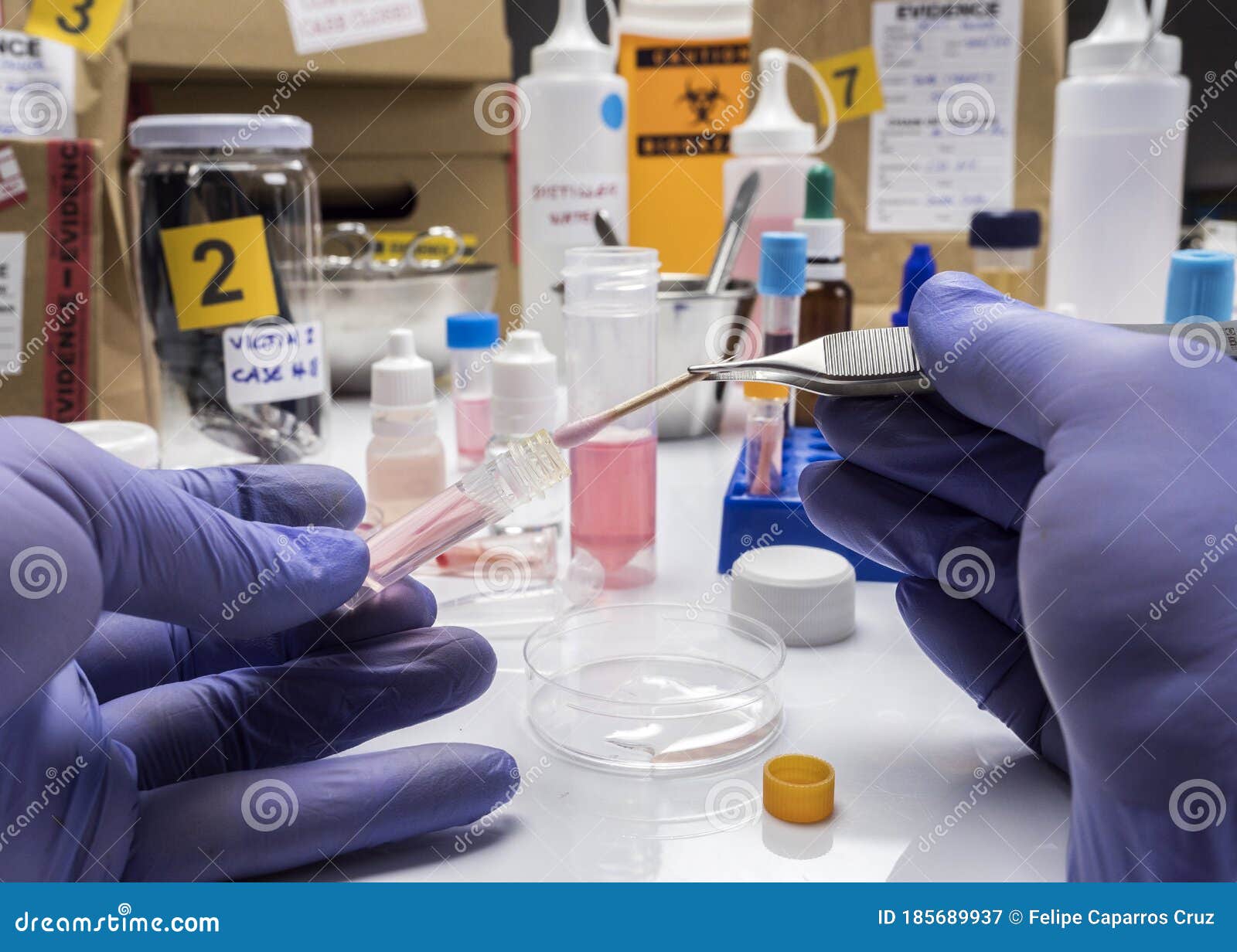 Specialized Criminalistic Police Performs Hematological Analysis with ...