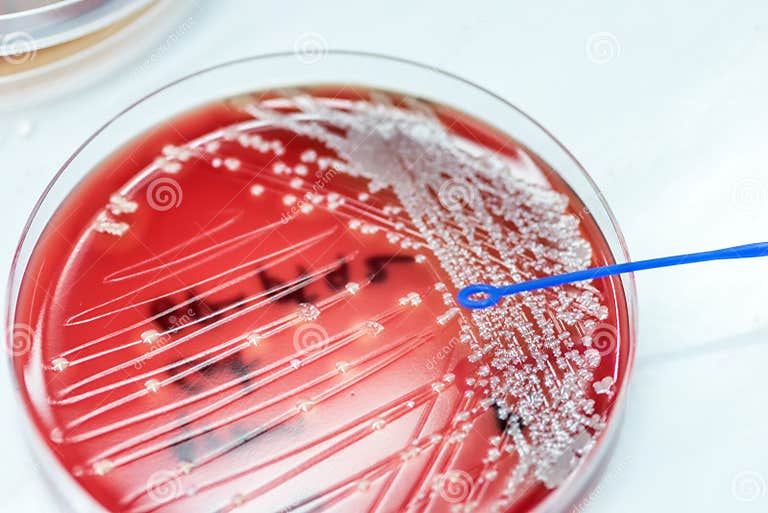 Speciesm De Staphylocoque (Staphylococcus Aureus) Photo stock - Image ...
