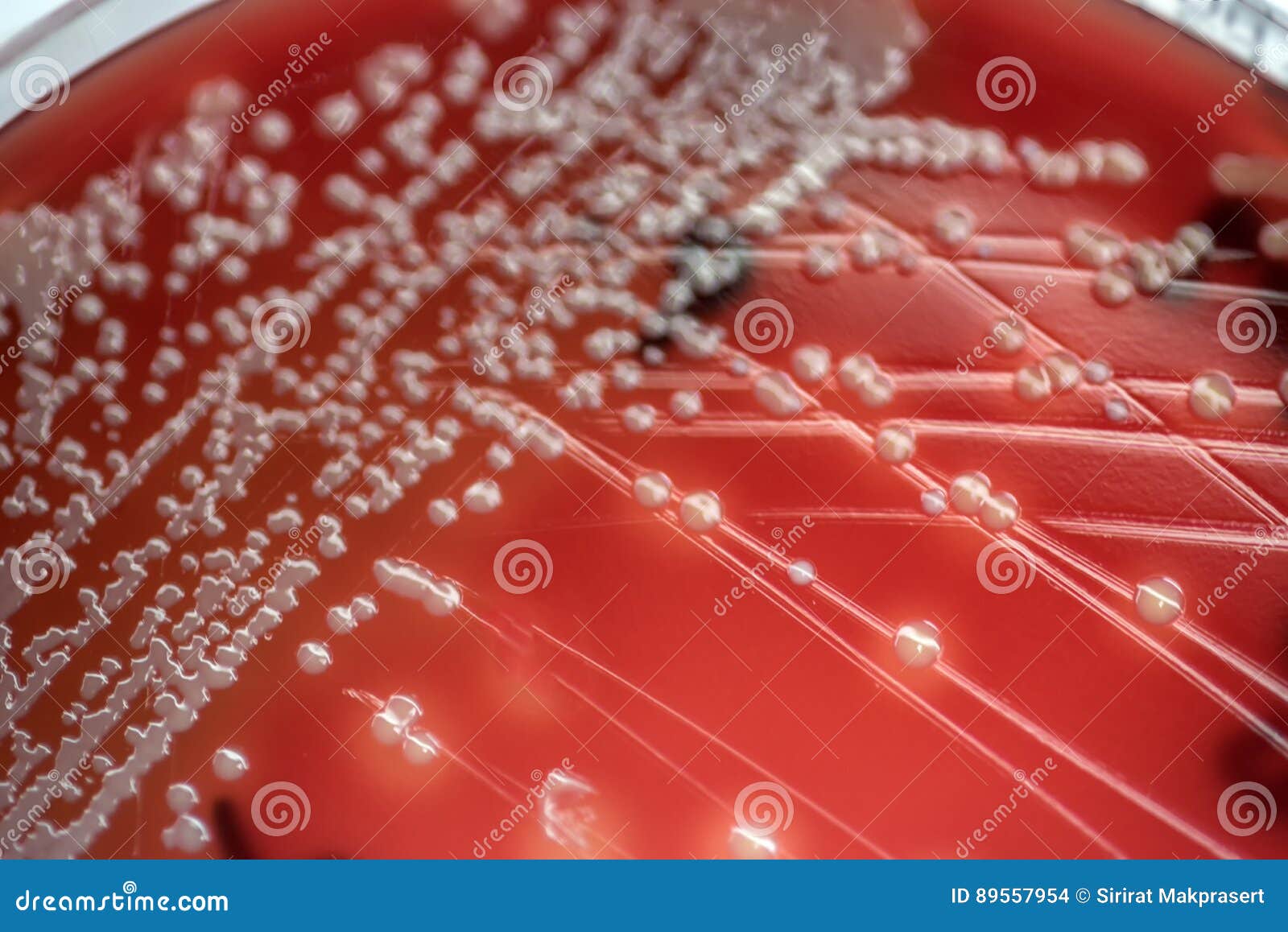 Speciesm Del Estafilococo (estafilococo áureo) Foto de archivo - Imagen ...