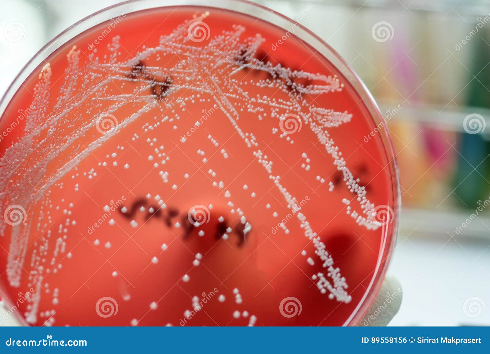 Speciesm Dello Stafilococco (staphylococcus Aureus) Fotografia Stock ...