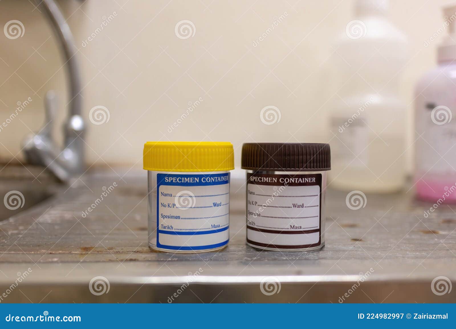 A Specimen Container for Lab Test Stock Image - Image of laboratory ...