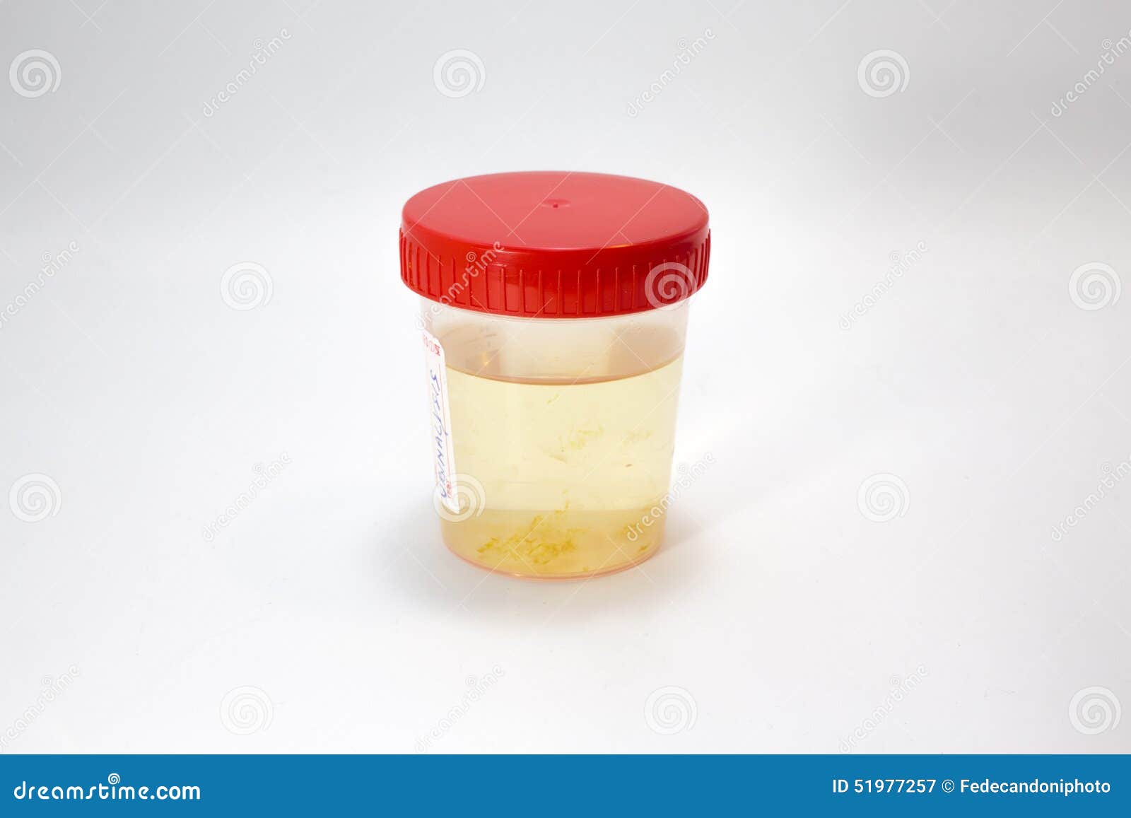 Urine Specimen