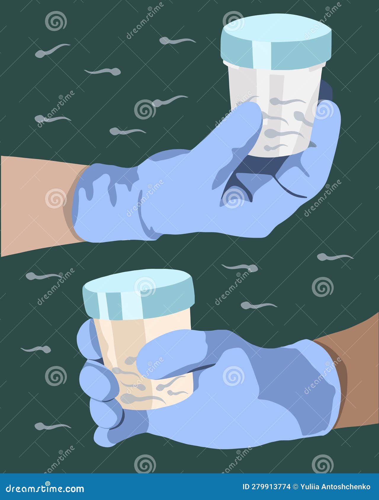 Spermogram And Semen Parameters, Teratozoospermia, Normal And Abnormal ...