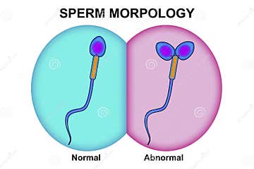 Sperm Morphology Comparison between Normal and Abnormal Stock ...