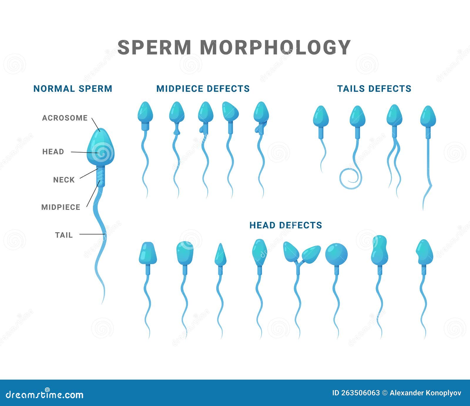 Sperm Morphology Count Type Educational Medical Scheme Vector Flat ... Sperm Morphology Count Type Educational Medical Scheme Vector Flat ...