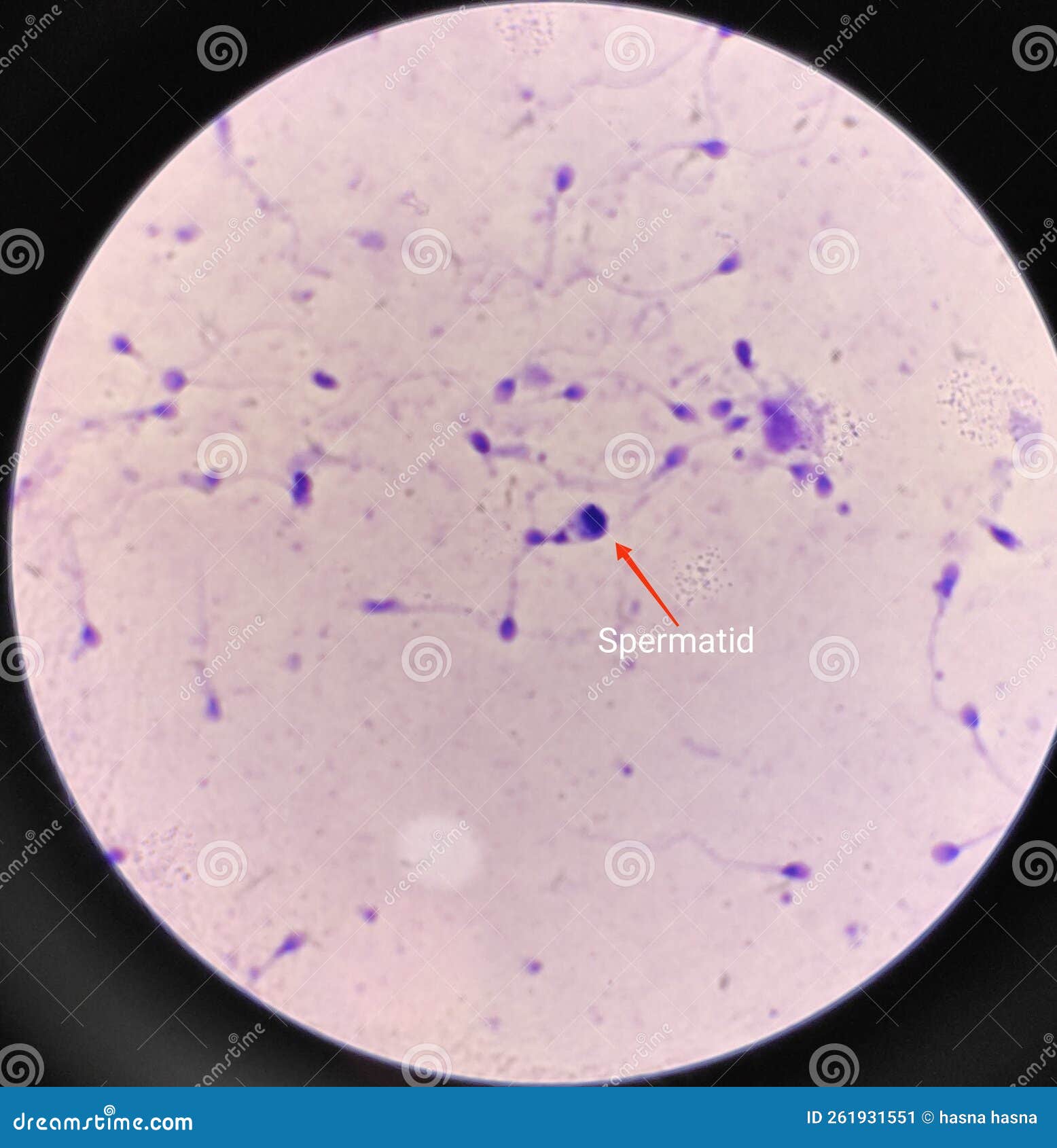 Spermatid in Sperm Analyzer Stock Image - Image of plasme, cell: 261931551