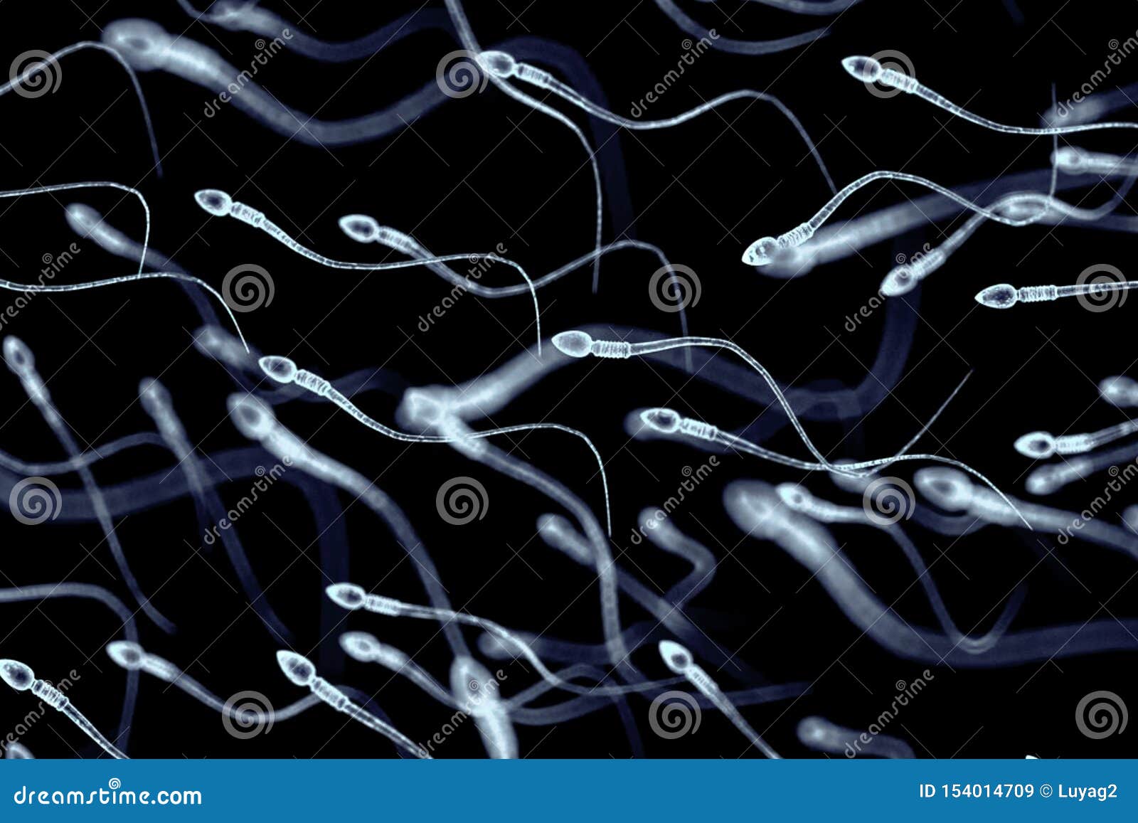 Spermatozoa, View Under Microscope, Illustration of the Appearan Stock ...