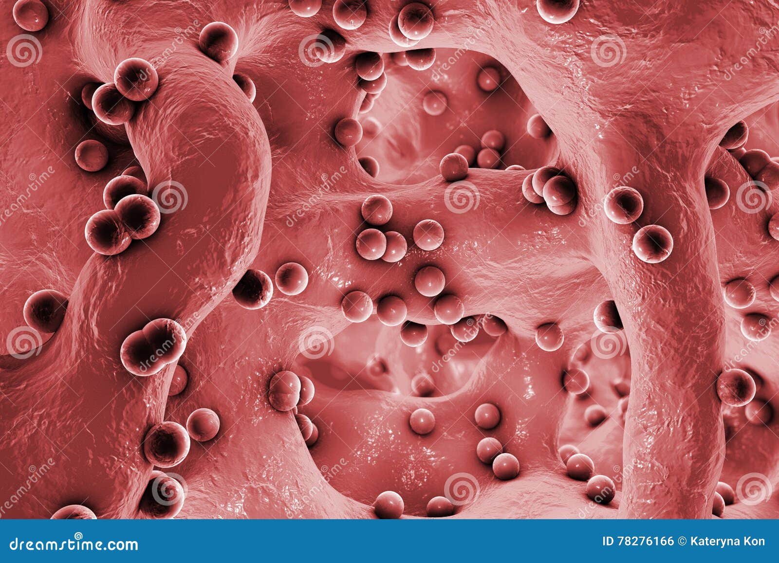 Spherical Bacteria On Skin With Hairs Royalty-Free Cartoon ...