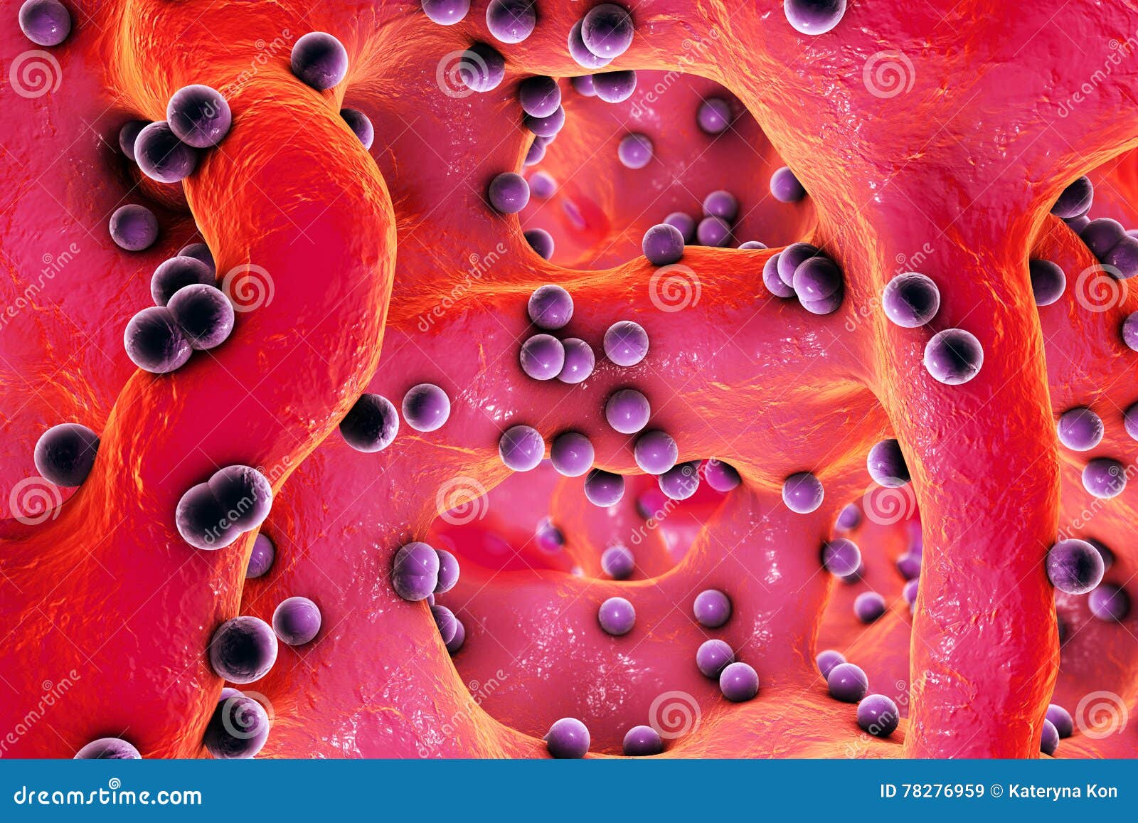 Spherical Bacteria Inside Bone Tissue Stock Illustration - Illustration ...