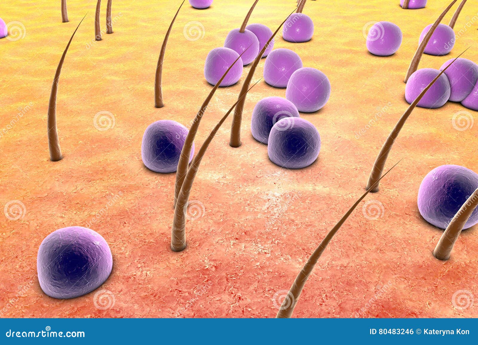Spherical Bacteria on Skin with Hairs Stock Illustration - Illustration ...