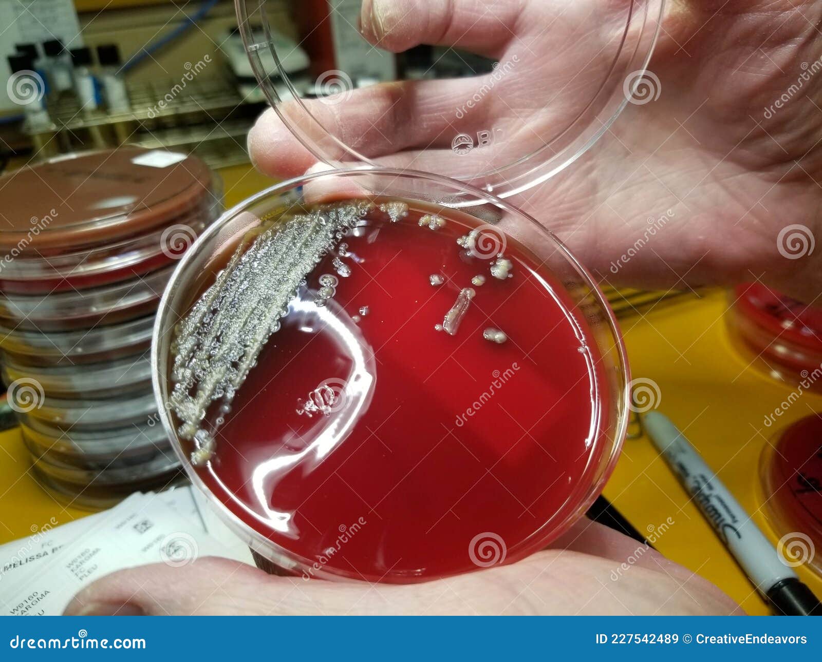 Sphingomonas Bacterial Colonies Growing on Blood Agar Plate Stock Image ...