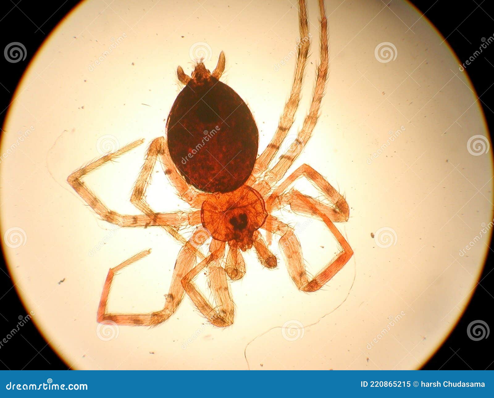 Spider Cell and it& X27;s Body Stock Image - Image of cell, body: 220865215