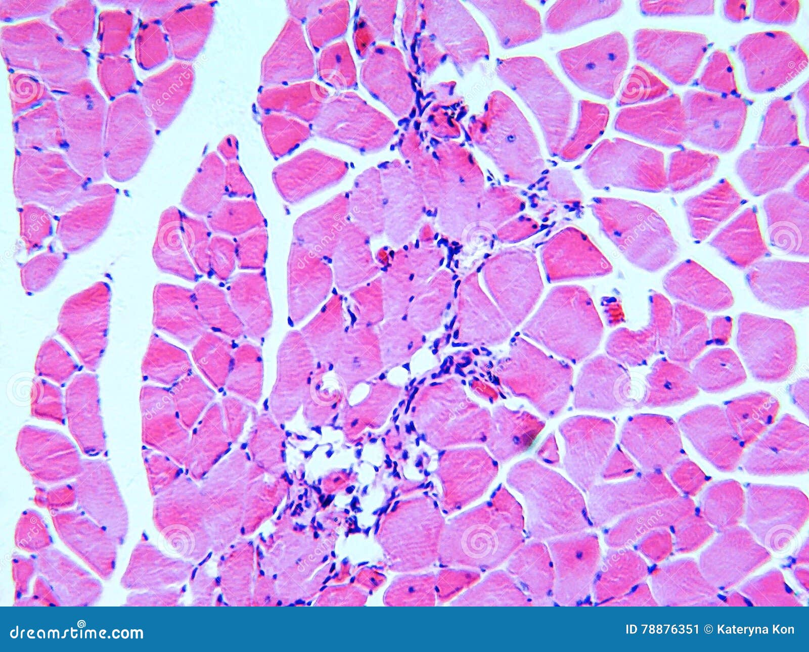 Spierweefsel, Lichte Microfoto Stock Afbeelding - Image of vergroting ...