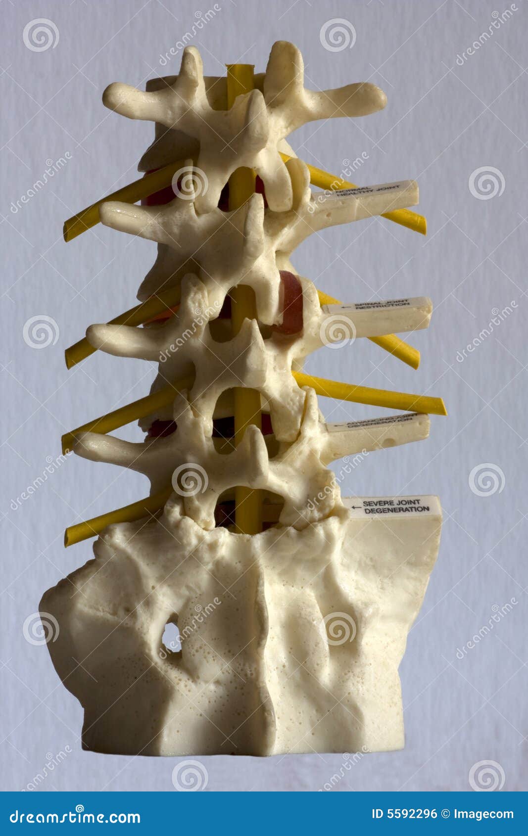 A spinal column model stock photo. Image of medical, closeup - 5592296 A spinal column model stock photo. Image of medical, closeup - 5592296
