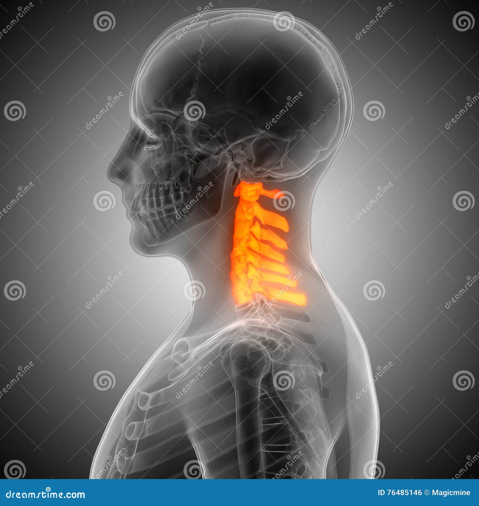 Anatomy Of The 7th Cervical Vertebra. Vertebra Prominens C7. Anterior ...
