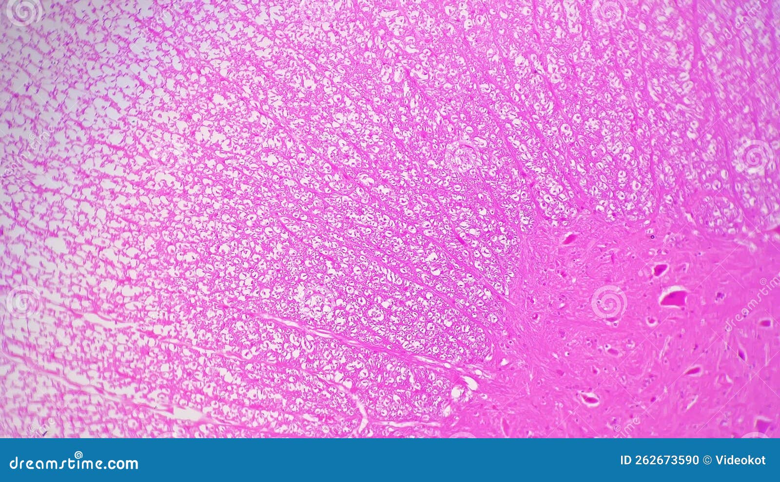 Spinal Cord Cell TS Microscopic Sample 100x Magnification Tinted Pink ...