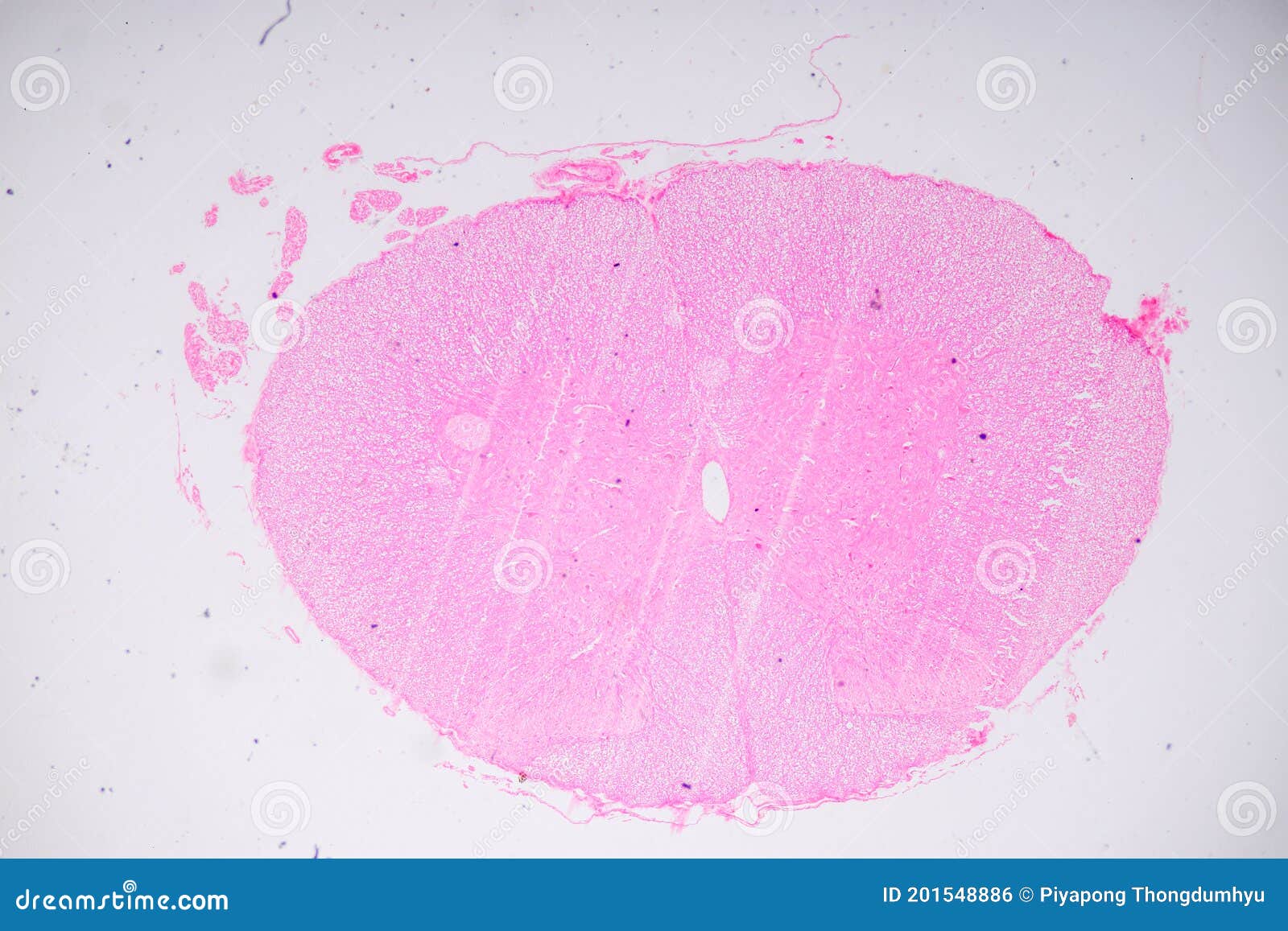 Spinal Cord and Motor Neuron Under the Microscope. Stock Photo - Image ...