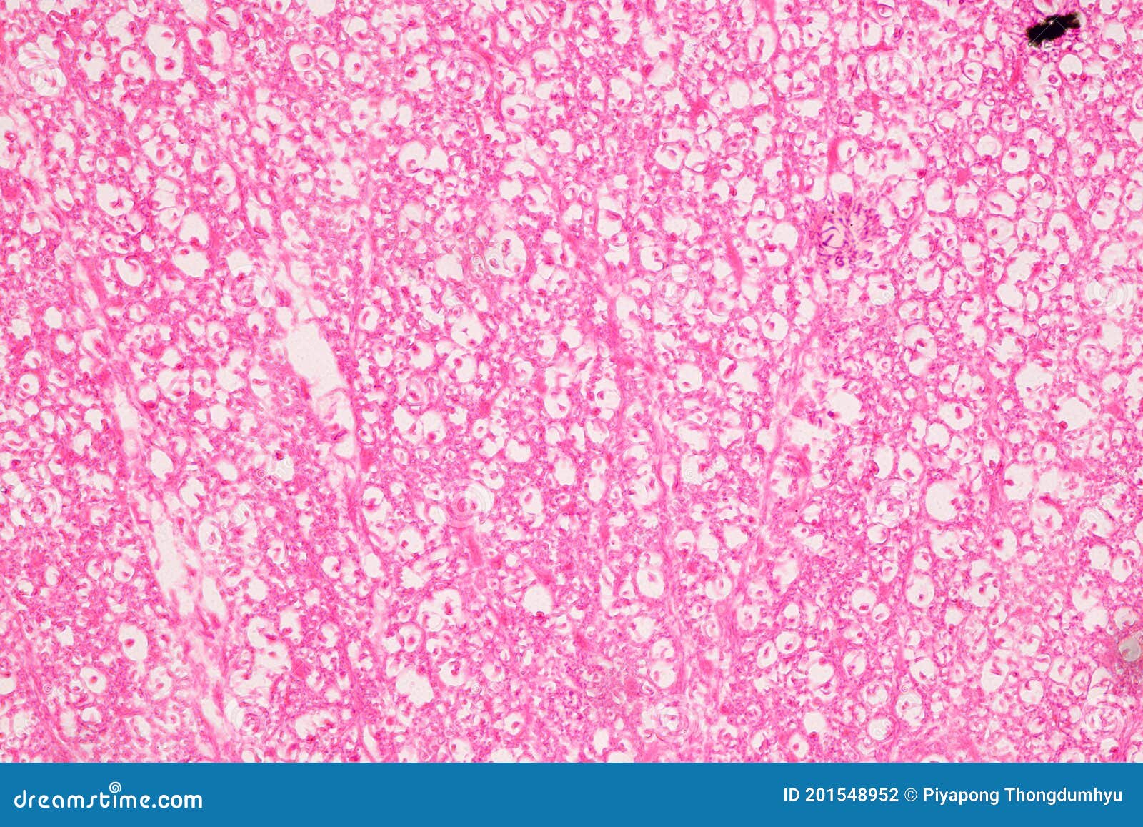 Spinal Cord and Motor Neuron Under the Microscope. Stock Photo - Image ...