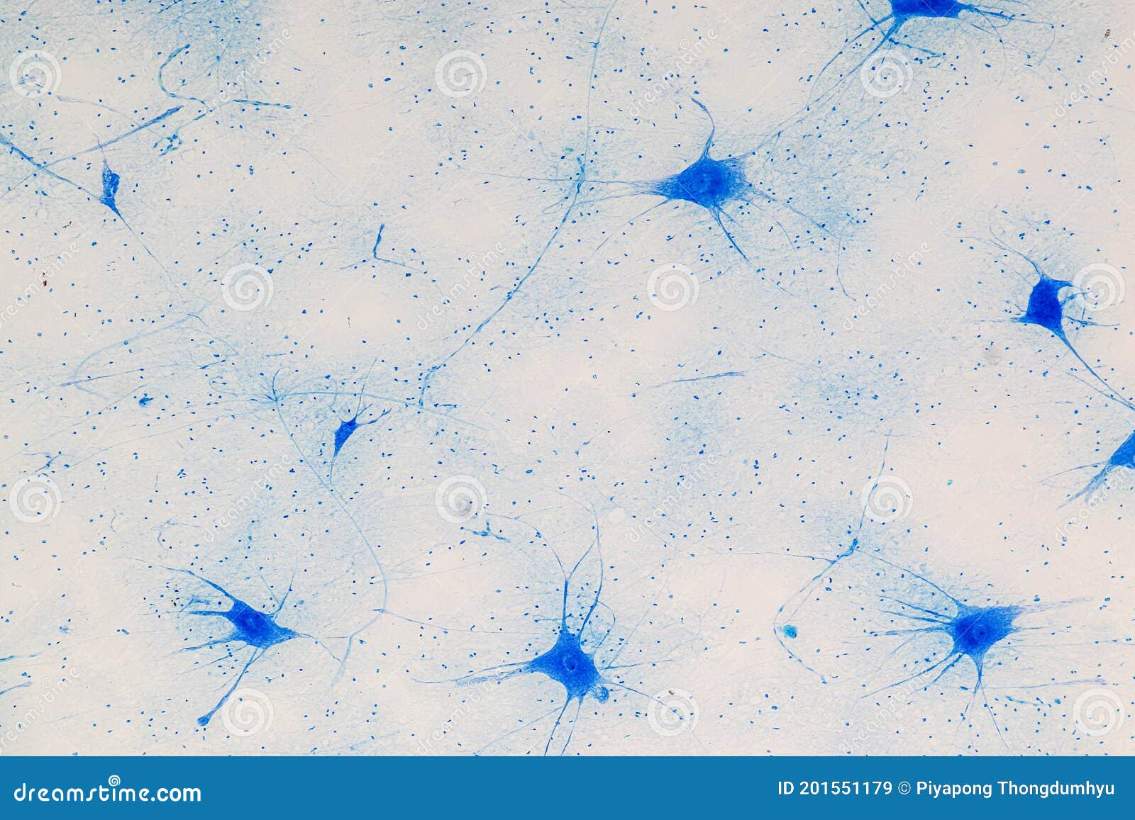 Spinal Cord and Motor Neuron Under the Microscope. Stock Image - Image ...
