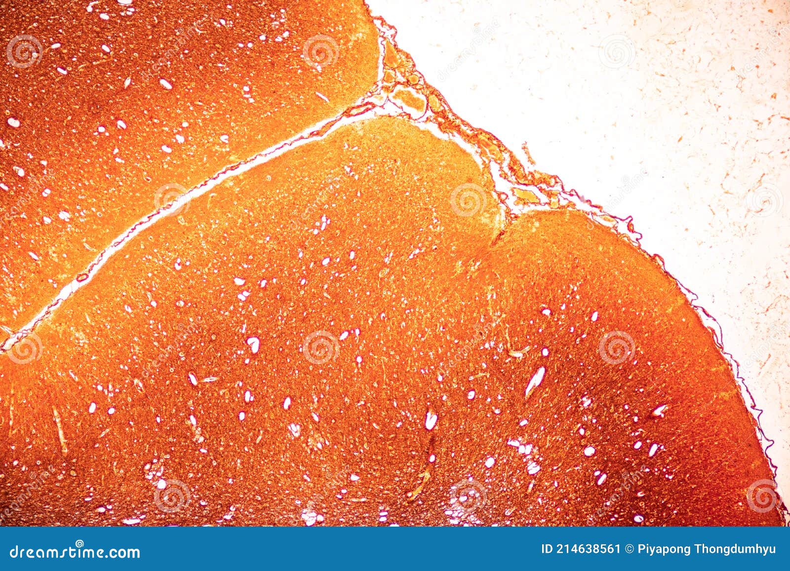 Spinal Cord, Nerve, Cerebellum, Cortex and Motor Neuron Human Under the ...