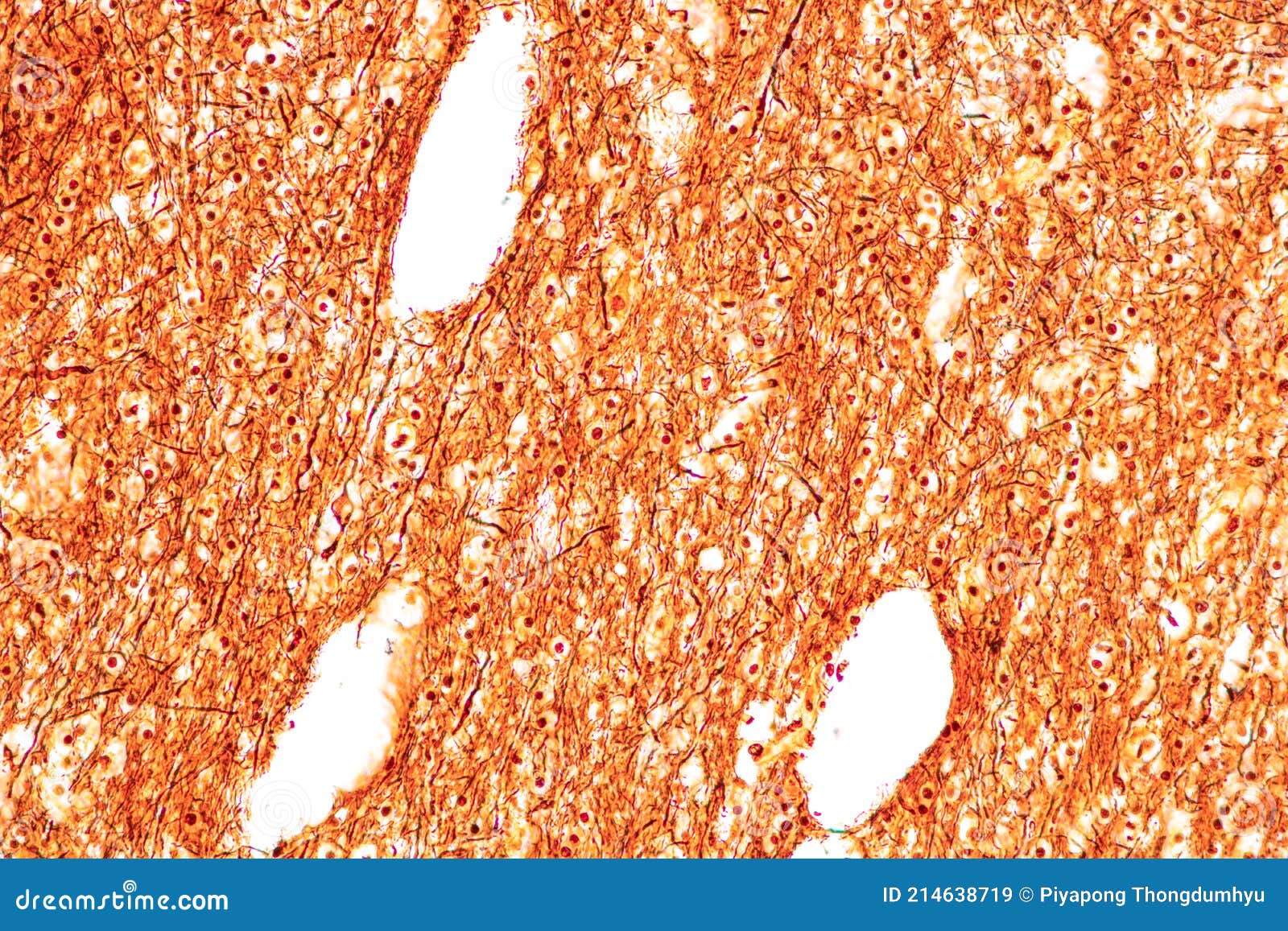 Spinal Cord, Nerve, Cerebellum, Cortex and Motor Neuron Human Under the ...