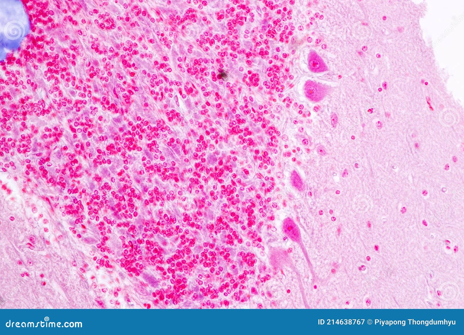 Spinal Cord, Nerve, Cerebellum, Cortex and Motor Neuron Human Under the ...