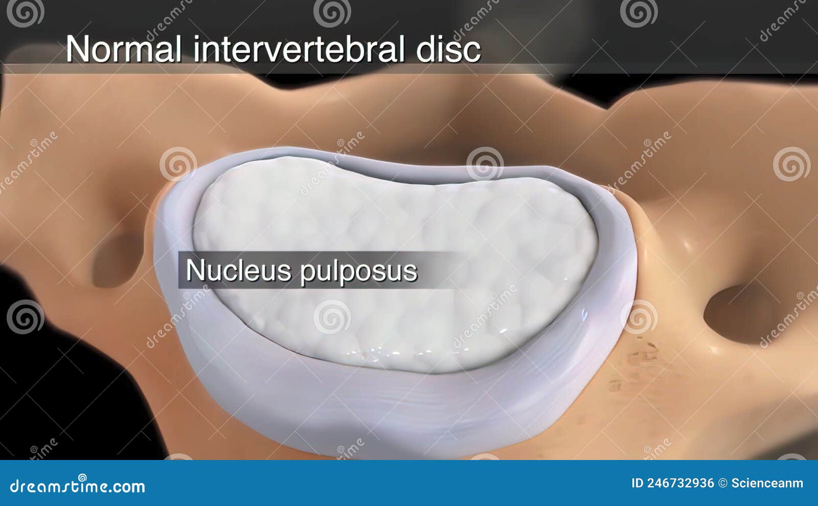 Spinal Cord , Normal Intervertebral Disc 3D Stock Illustration ...