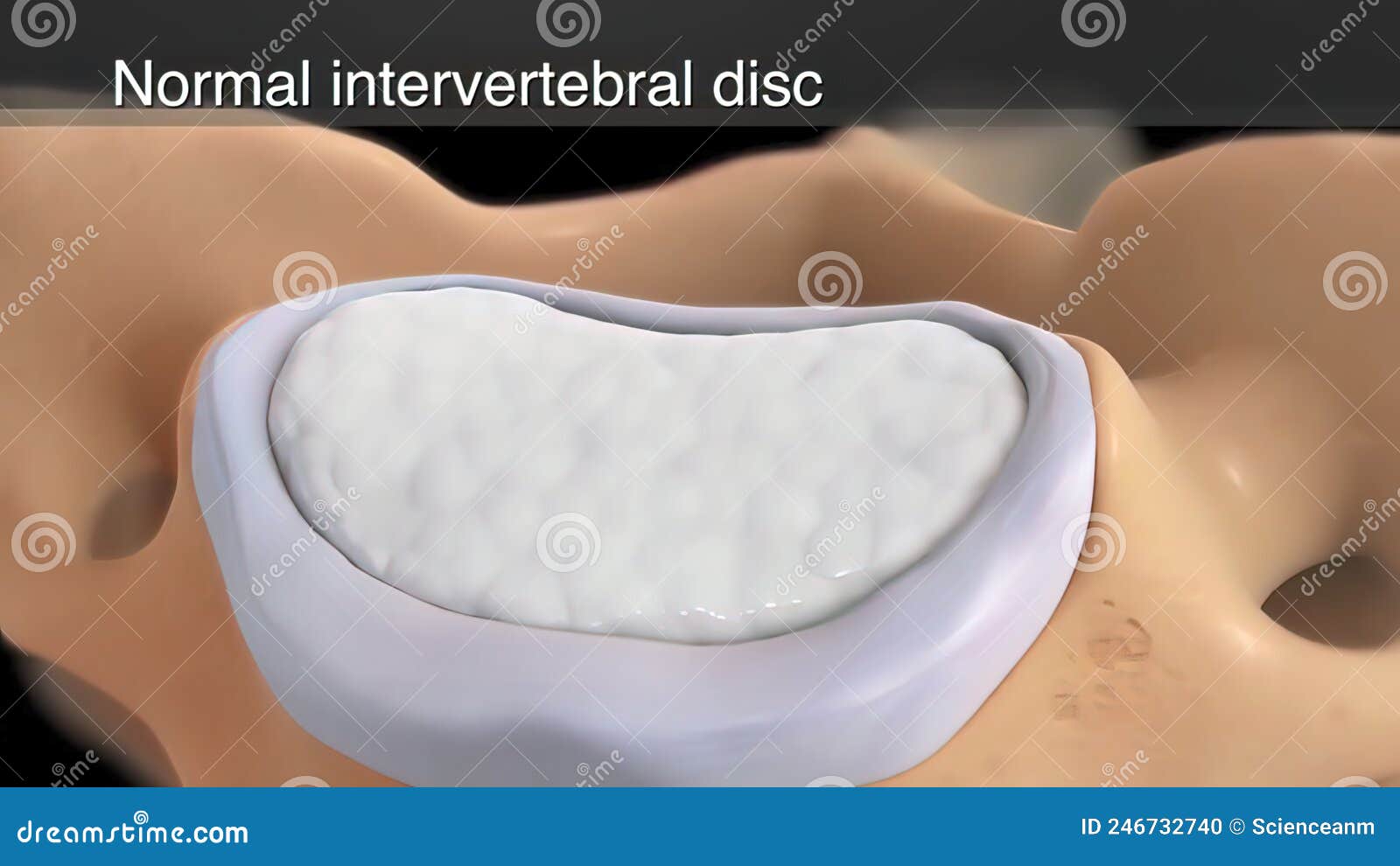 Spinal Cord , Normal Intervertebral Disc 3D Stock Illustration ...