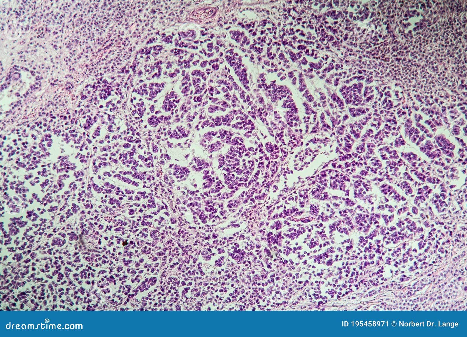 Spinal Cord Tissue Section Under the Microscope Stock Image - Image of ...