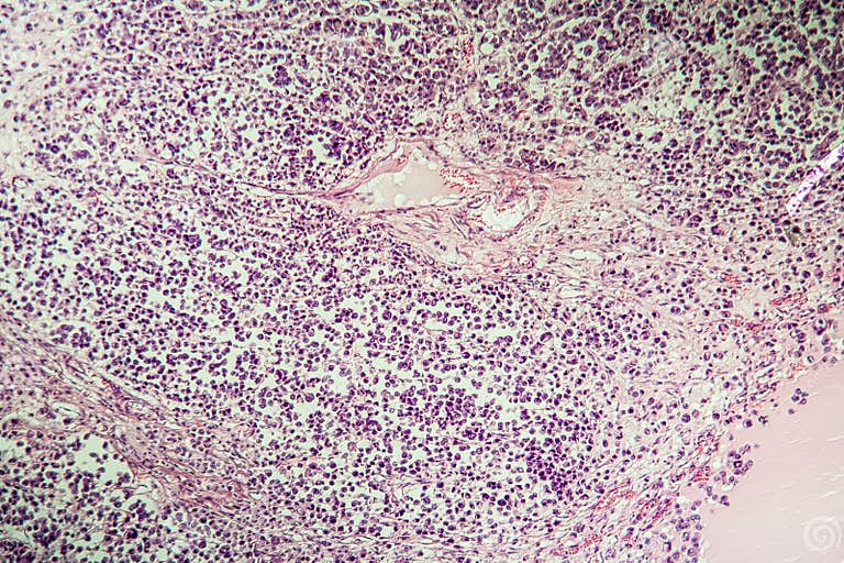 Spinal cord tissue section stock image. Image of spinal - 196723901